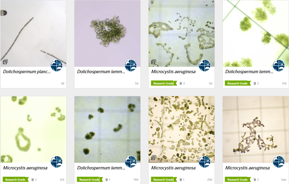 What does cyanobacteria look like? ~ Here are some microscope photos ...